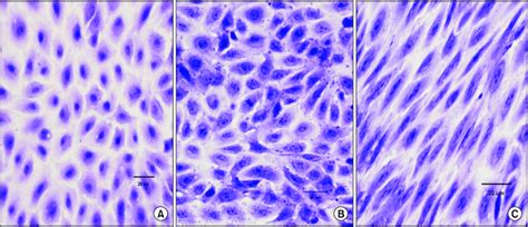 Morphology Of Cultured Endothelial Cells Ecs In Vitro After 5 Days