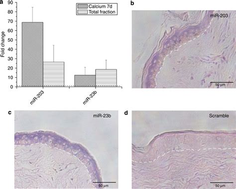 Microrna 203 Mir 203 And Mir 23b Are Differentiation Markers Of Human