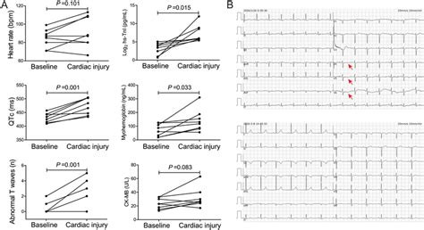 Dynamic Changes Of Electrocardiogram ECG A The ECG Parameters And Download Scientific