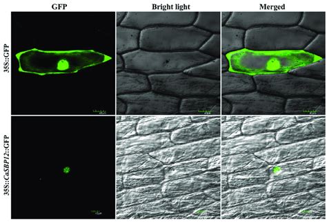 Subcellular Localization Of The Casbp12 Protein Transient Expression