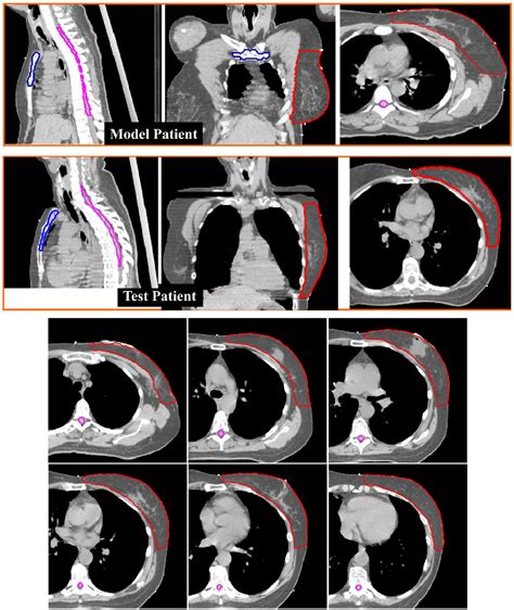 Seg Algorithm Semantic Scholar