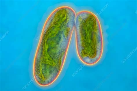 Serritaenia Sp Algae Light Micrograph Stock Image C056 2871 Science Photo Library