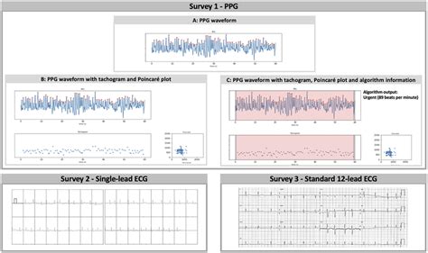 Survey 1 A Ppg Waveform B Ppg Waveform With Tachogram And Download Scientific Diagram