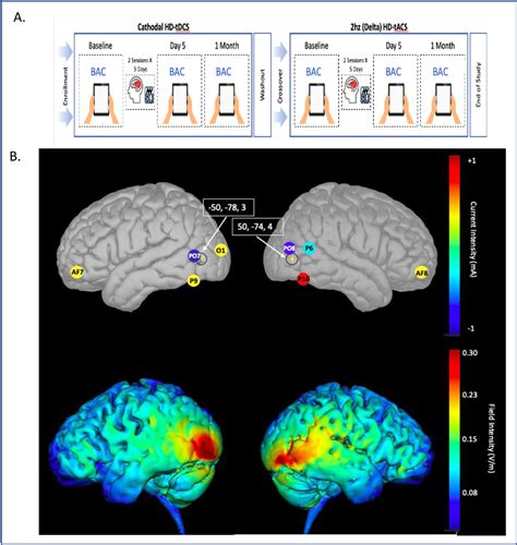 Figure 1 From Lesion Network Guided Delta Frequency Neuromodulation Improves Cognition In