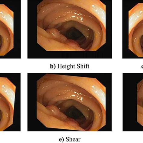 Data Augmentation Examples Used In The Study Download Scientific Diagram