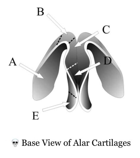 Yousef Nazari On Linkedin 💀 Base View Of Alar Cartilages A Lateral Crus B Middle Crus Domal…