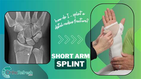 How Do I Splint A Distal Radius Fracture