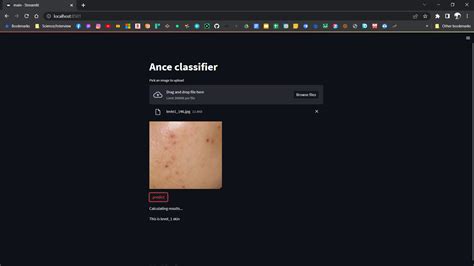 Github Yinchuangsum Acne Demo