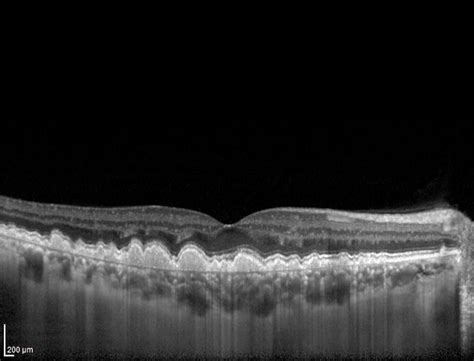 Oct Scan Tatadesigns