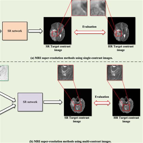 The Challenges Of Mri Sr Specifically The Mri Sr Approach In Figure Download Scientific
