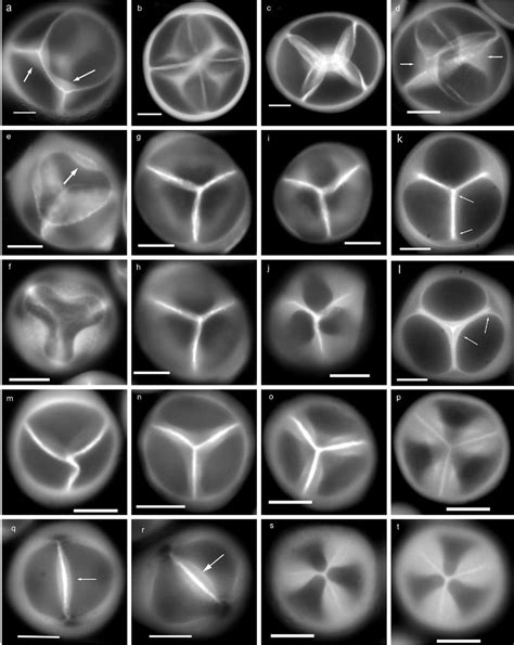 Fluorescent Light Micrographs Of Additional Callose Deposits After