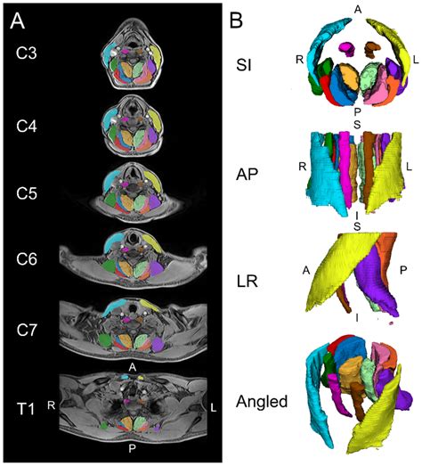 Example Images Are Shown For The Automated Segmentation Of The Cervical Download Scientific