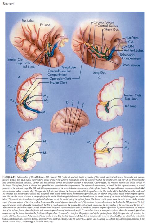 Where Does The Middle Cerebral Artery M1 Segment Become The M2 Segment Thread From Francis
