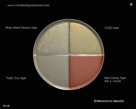 Enterococcus Faecium Vs Faecalis En Agar Sangre Pdf Phenotypic And