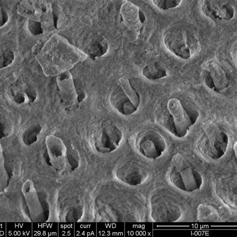 Note Solid Cylindrical Structures Thin Arrows And Two Structures Download Scientific Diagram