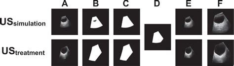 Overview Of The Pre Processing Procedure A Spatially Corresponding