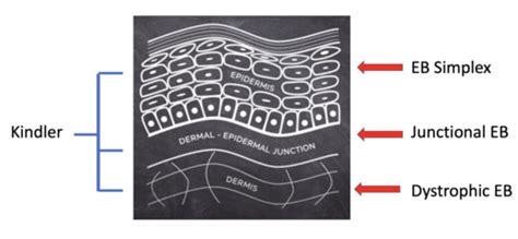 Genodermatoses Flashcards Quizlet