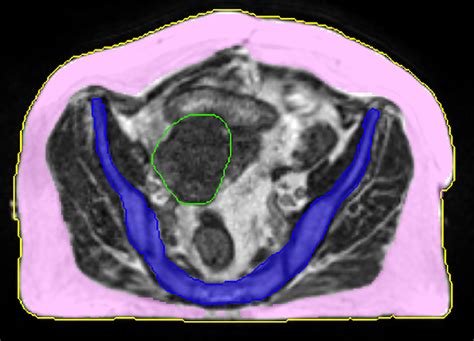 Example Of BDO Figure X An Example Of The BDO Method Used In MAP RT Download Scientific