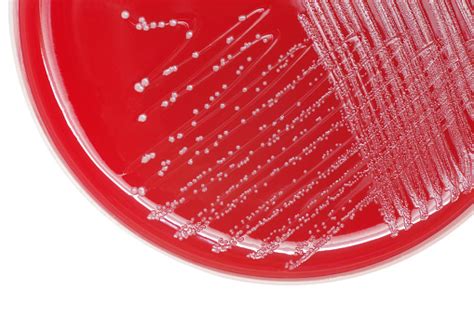 Foto De Gama Hemolítica Streptococcus Fungos Colônias E Mais Fotos De