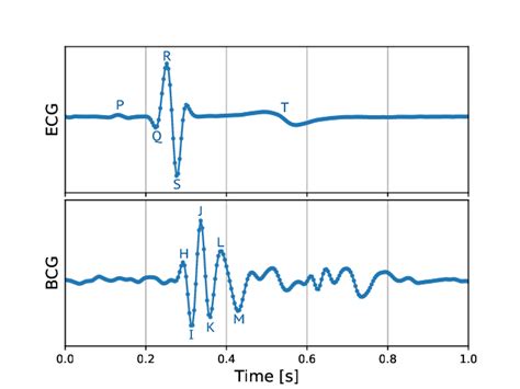 Example Of Acquired Ecg And Bcg Signals After The Fir Filter Detailed Download Scientific