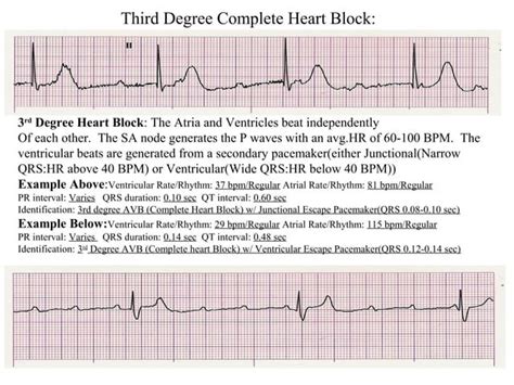 Algorithm For Rhythm Interpretation1 Ppt