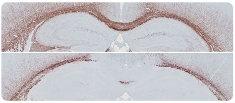 Cuprizone Models Of Multiple Sclerosis Ms Biospective