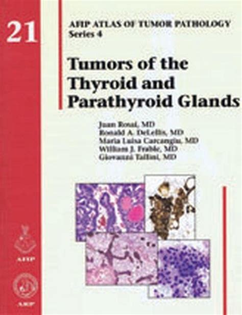 Afip Atlas Of Tumor Pathology Series 4 Ser Tumors Of The Thyroid And Parathyroid Glands By
