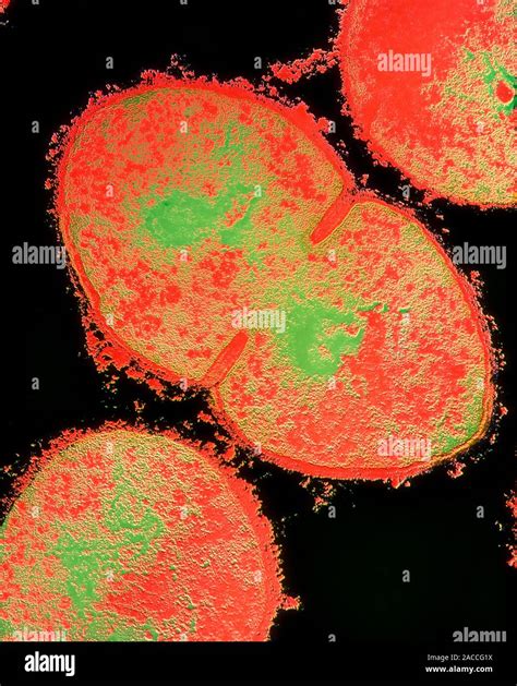 Resistant Streptococcus Strain Transmission Electron Micrograph Of A