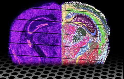 Nova St Open Source Platform For Spatial Transcriptomics Innovations Report