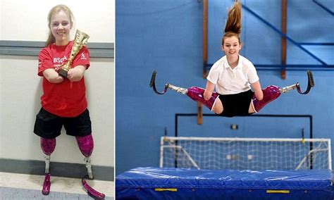 Люди Без Рук Без Ног Фото —