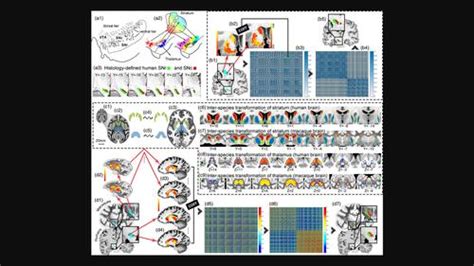 基于纹状体黑质纹状体连接的人类和猕猴黑质的跨物种分割 Human Brain Mapping X Mol