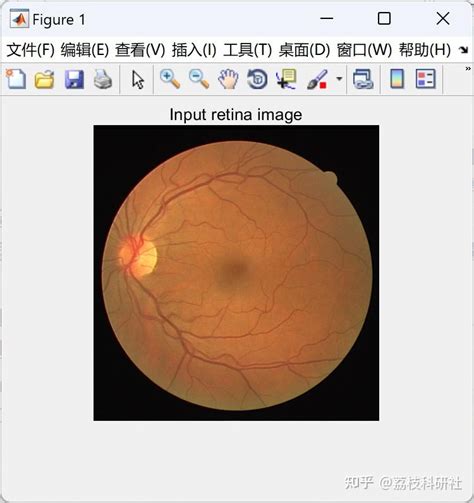 【图像分割】视网膜图像分割以提取血管的复杂结构（matlab实现） 知乎