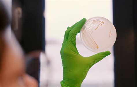 Root Associated Microbiomes