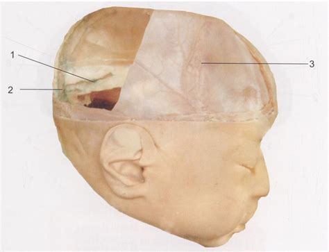 脑膜 1 人体解剖标本 医学