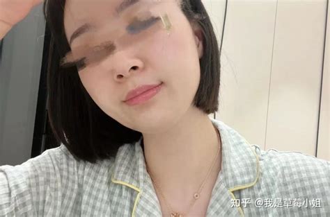 如何有效淡化脸上的痘印？ 知乎