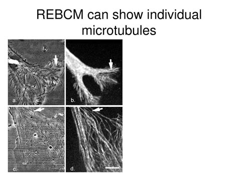 Ppt Structured Illumination Microscopy And Reflection Confocal Powerpoint Presentation Id 664795