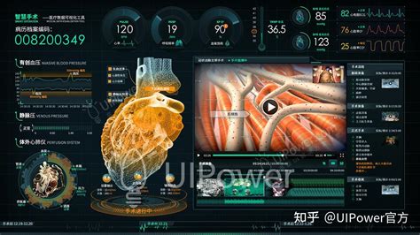 智慧医疗3d数据可视化，医疗可视化系统 Uipower 知乎