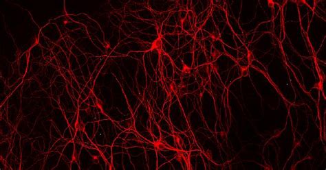 Some Neurons I Grew Imgur