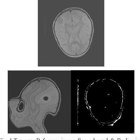 Figure 1 From Non Rigid Registration Of Medical Images Using An Automated Method Semantic Scholar