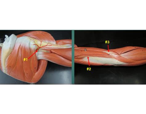 Peripheral Nerves Arm Quiz