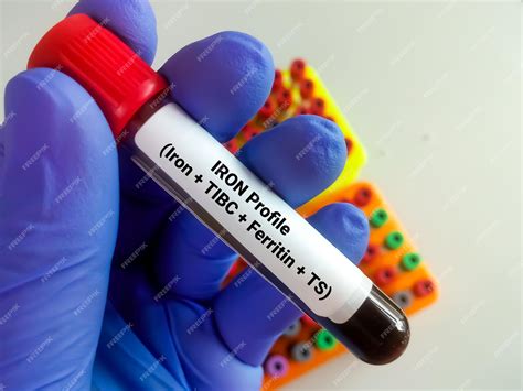Premium Photo Iron Profile Testing Including Iron Tibc Ferritin And Transferrin