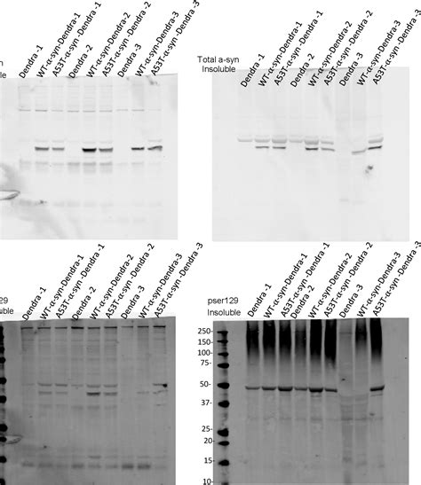 Figure 1 From Optical Pulse Labeling Studies Reveal Exogenous Seeding Slows α Synuclein