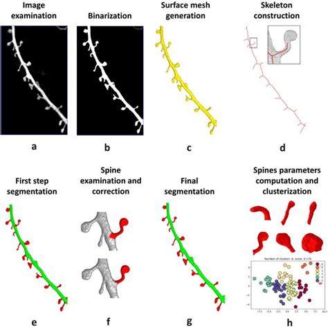 Dendritic Spine Shapes Descriptor—chord Length Distribution Histogram Download Scientific