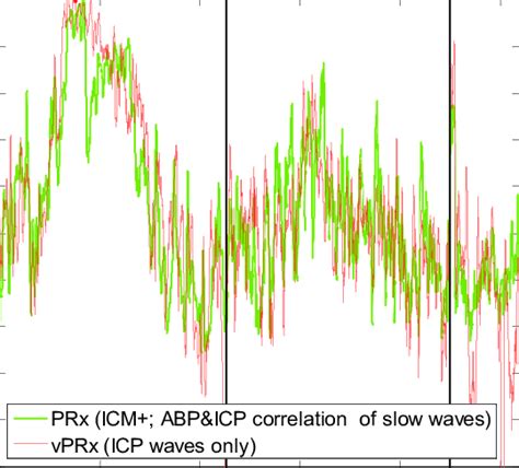 250 Hours Of Prx Monitoring On 3 Tbi Patients Grey Line Icp And Abp