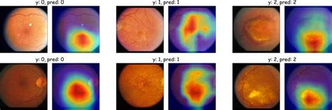 Grad Cam Selvaraju Et Al 2017 Saliency Maps Of Our S Models