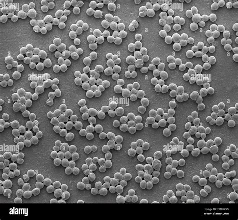 Group A Streptococcus Bacteria SEM Stock Photo Alamy
