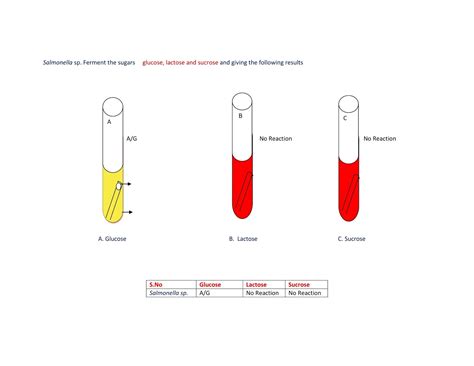 Senthil Prabhu Sivasamy Carbohydrate Fermentation Test