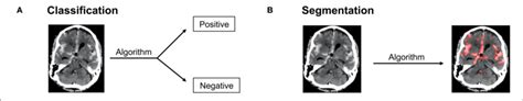 A Schematic Representation Of A Classification And B Segmentation