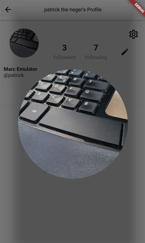 How To Hide Shadow Of A Dialog Box In Flutter Stack Overflow