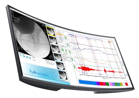 Morpheus® Uroflowmetry The Prometheus Group®